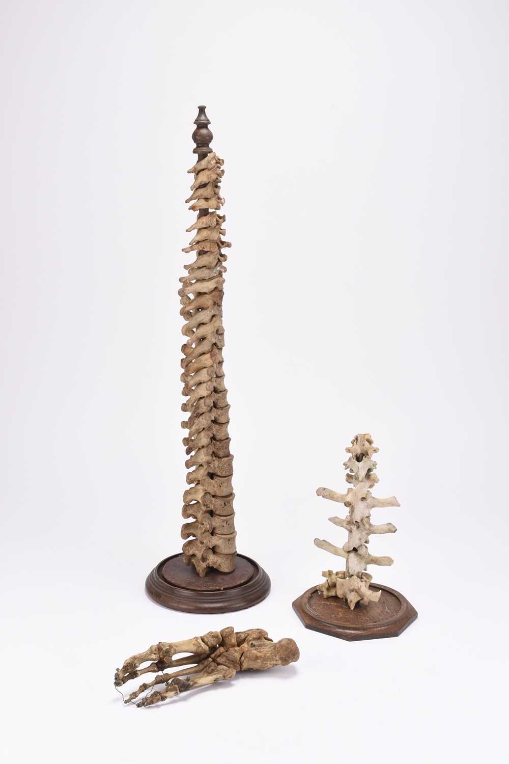 Lot 54 - Anatomy: A human spinal column and foot, 19th